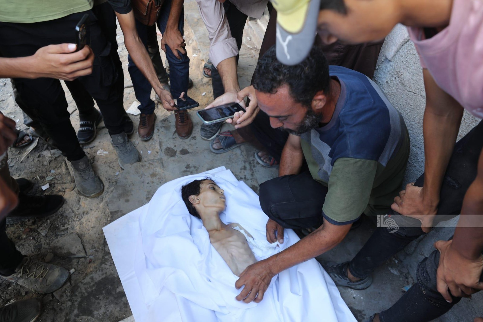 5 na namatay dahil sa taggutom at malnutrisyon sa nakalipas na 24 na ...